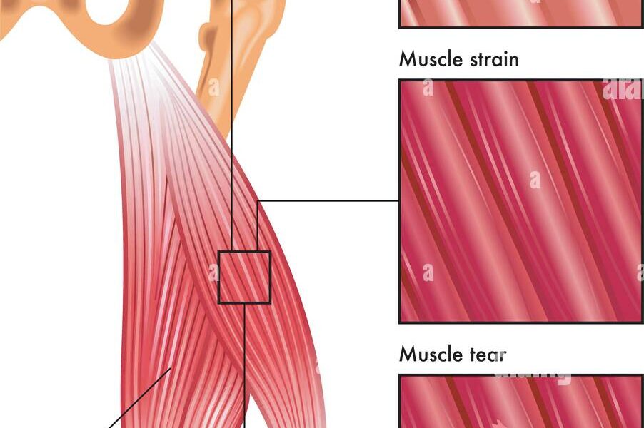 La importancia de incluir fibras blancas y rojas en tu dieta diaria ...
