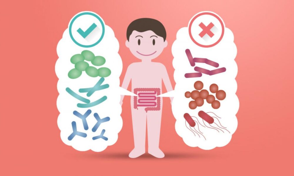 Descubre los alimentos ideales para mejorar tu flora intestinal - Es ...