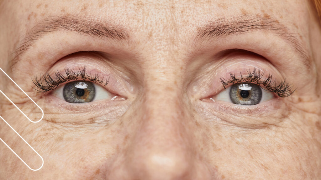 ¿Qué hacer si veo una mosca en el ojo? Guía rápida de prevención y ...