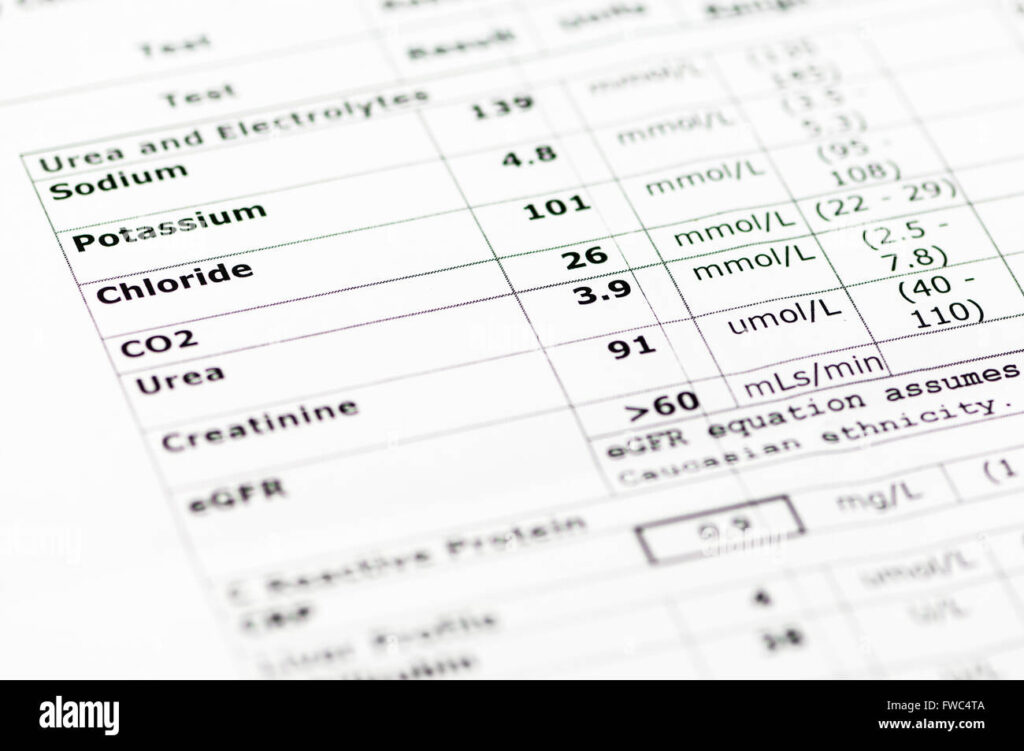 Qué es la creatinina y por qué es importante para tu salud renal - Es ...